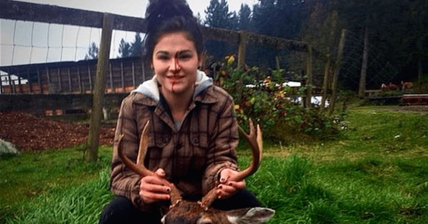 11 Pictures of People Who Got Scope Eye (Laugh WITH Them, Not at Them ...