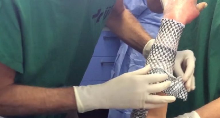 Fish Skins for First Aid? This is No Fish Story... - Wide Open Spaces