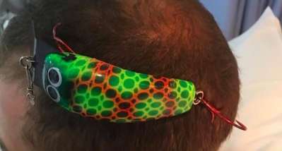 This Woman's Fish Hook Body Modifications Are Absolutely Unreal - Wide ...