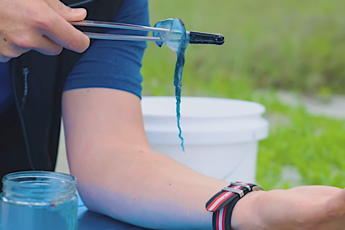 Man Purposely Takes Two Portuguese Man O' War Stings to Test Home ...