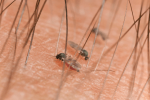 Biting Flies: 5 Kinds and How to Stop Them