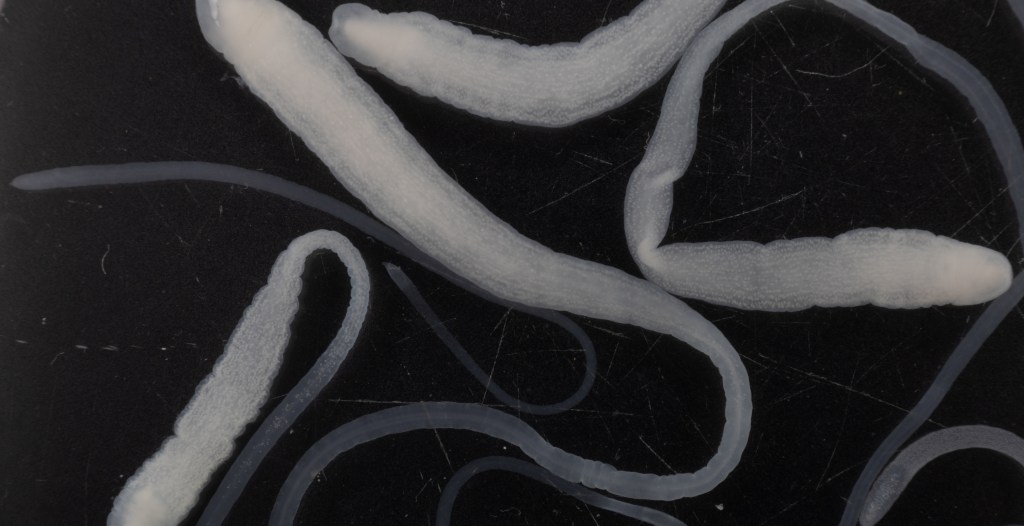 Stomach Turning CT Scan Shows Damage Parasites Can Wreck On The Body ...