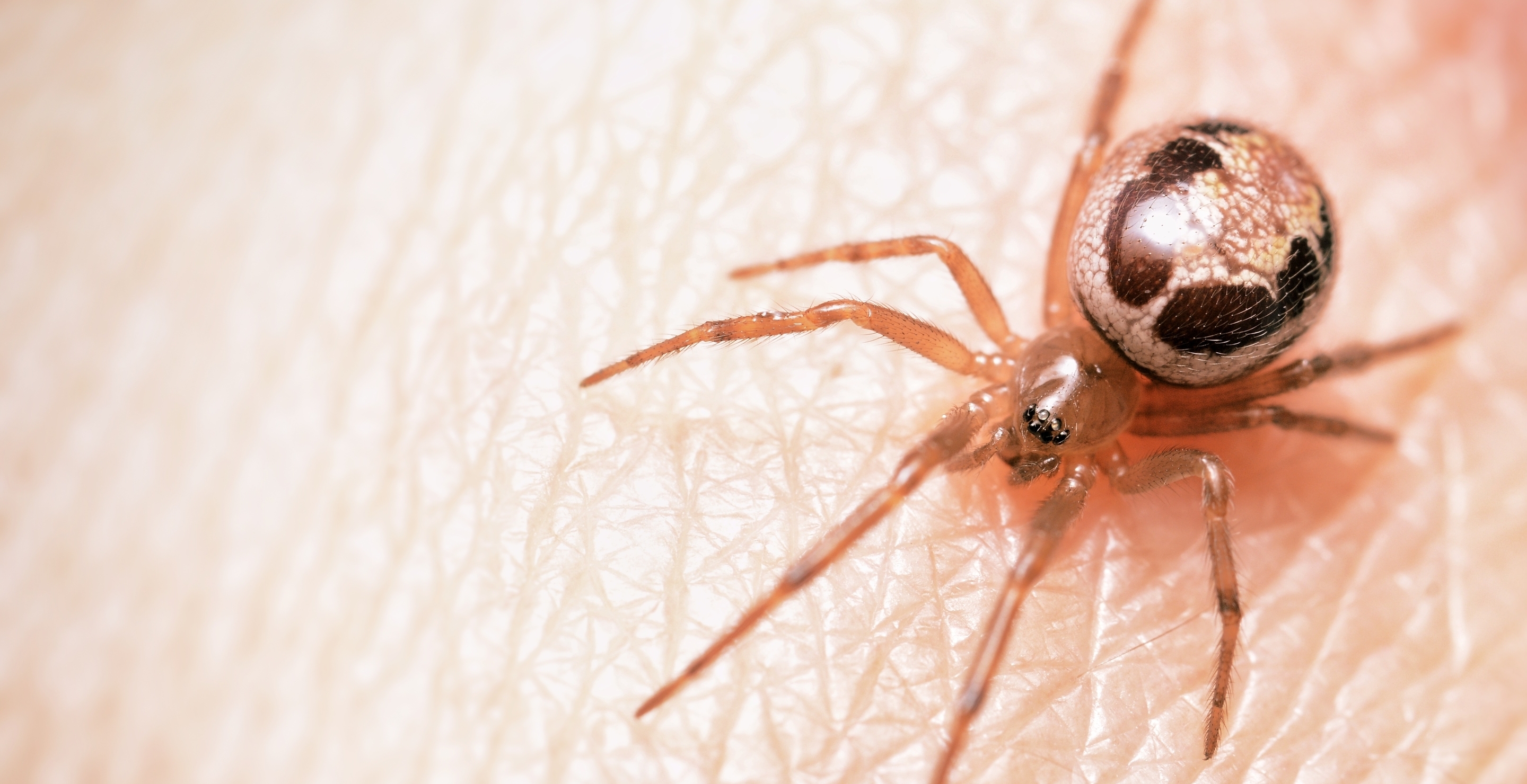 Dad Hospitalized After Spider Bite Gives Him Flesh Eating Bacteria ...