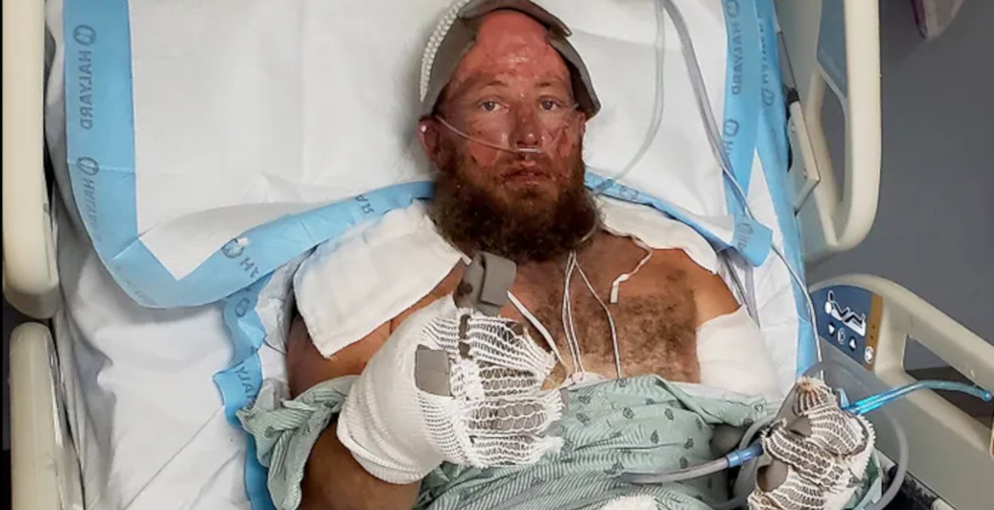 Florida Captain Details Terrifying Moment His Boat Exploded - Wide Open ...