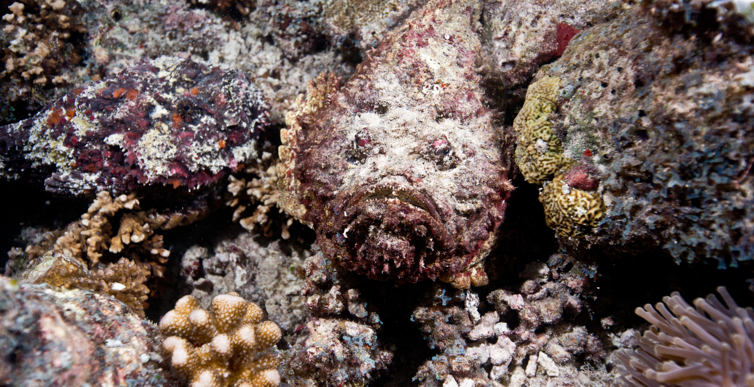 Terrifying Moment A Paramedic Realized He Was Stung By World's ...