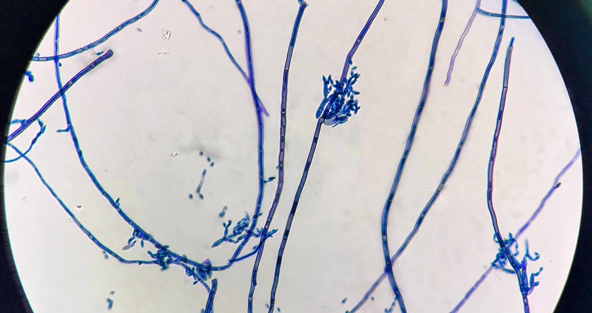 Radiation At Chernobyl Is Mutating One Species In A Very Peculiar Way ...